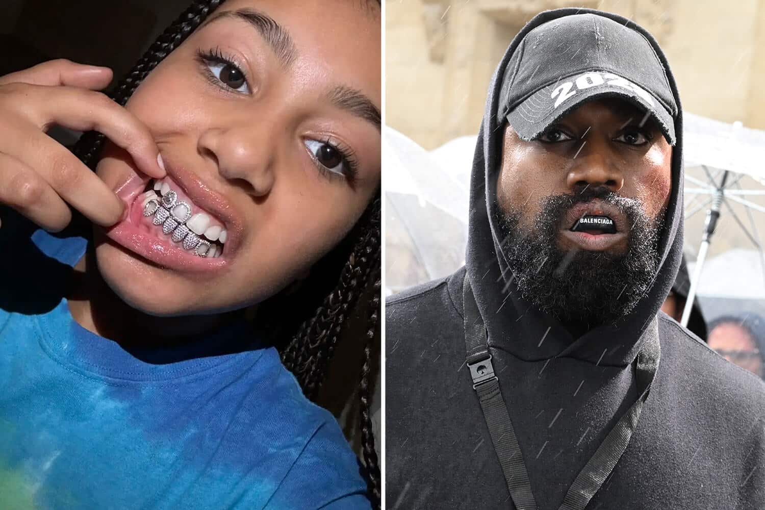 Kanye & North West’s Grills: Celebrity Smiles & Prosthodontics